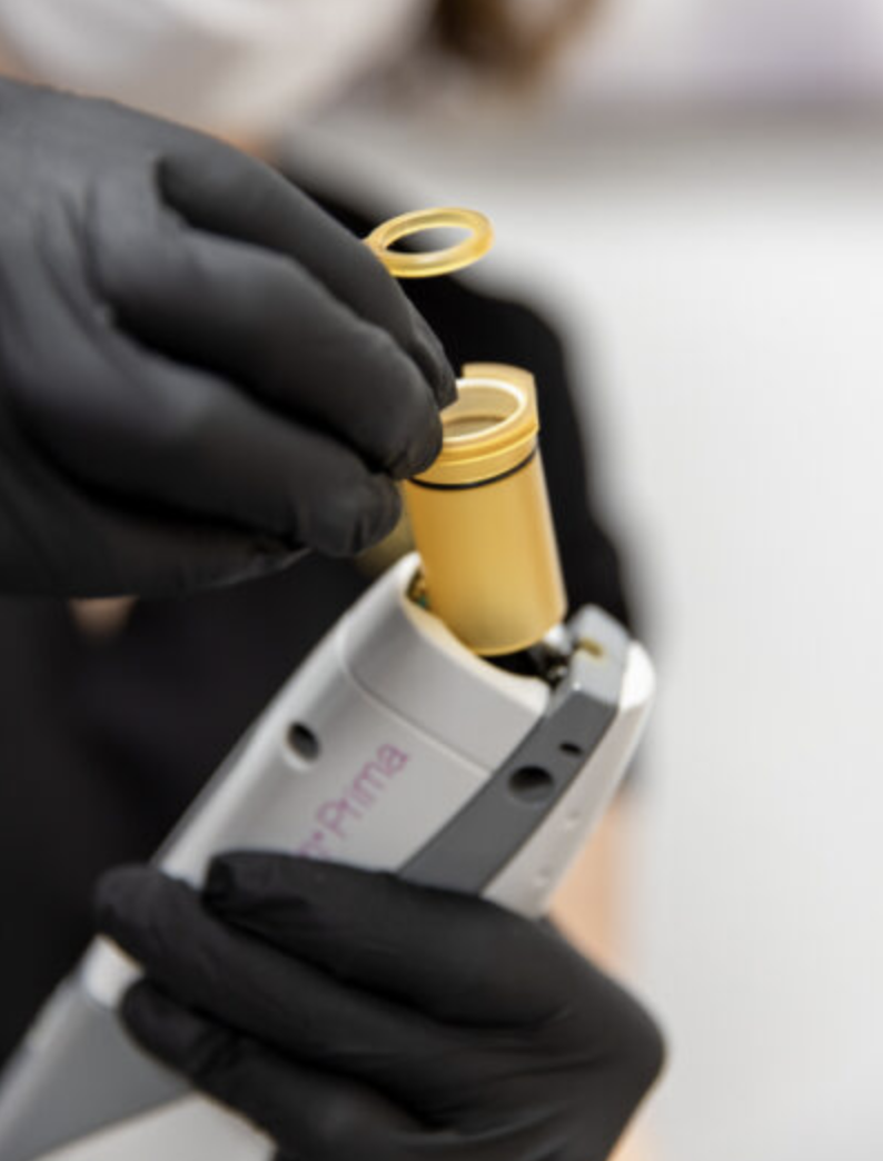 VBeam Laser: Say Goodbye to Redness and Hello to Clearer Skin! - Entre Nous